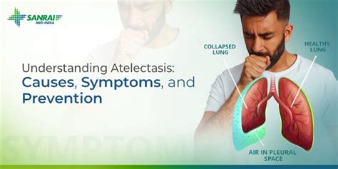 Understanding Atelectasis Causes Symptoms Prevention Sanrai Med India Medium
