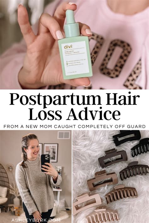 Postpartum Hair Loss Artofit