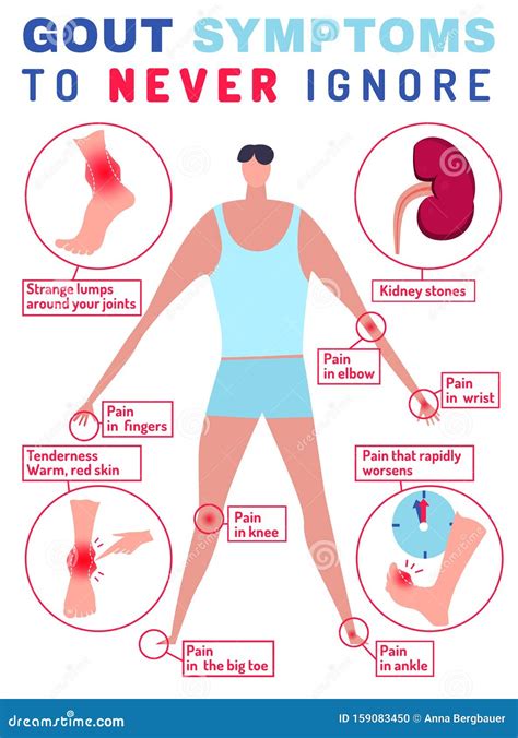 Gout Arthritis Icon Vector Illustration 159083456