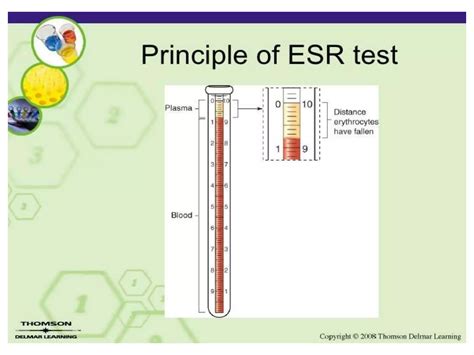 Erythrocyte Sedimentation Rate PPTX