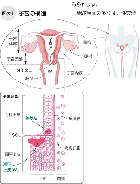 子宮頸がんとは Npo法人キャンサーネットジャパン