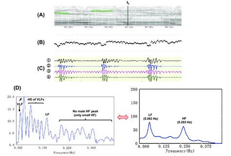 Comparison Between Instantaneous Time Frequency Analysis And Power