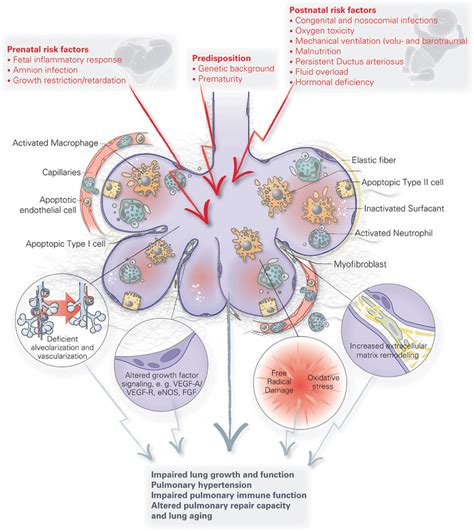 A Schematic Overview Of The Pathophysiology Of Bronchopulmonary Download Scientific Diagram