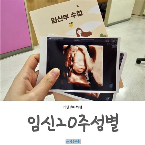 임신20주 성별반전 태아 아기성별확인 주수 입체초음파 시기 네이버 블로그