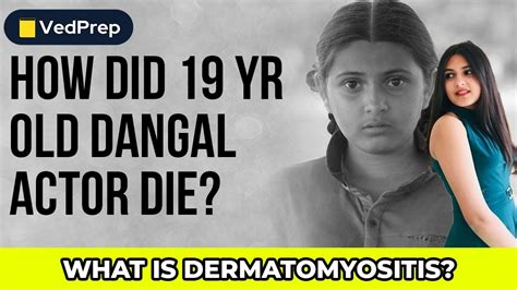 What Is Dermatomyositis Symptoms Causes And Treatments Vedprep