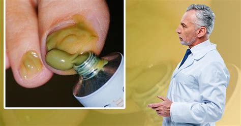 Средство против грибка ногтей