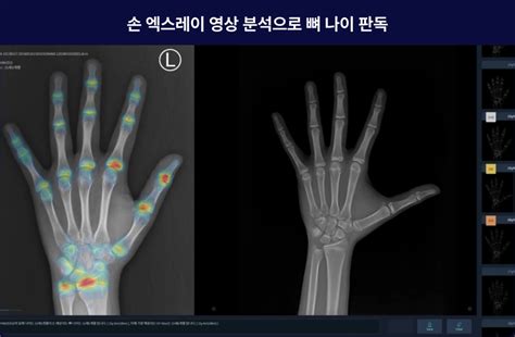 딥러닝을 활용한 의료 영상 처리 And 모델 개발 패스트캠퍼스