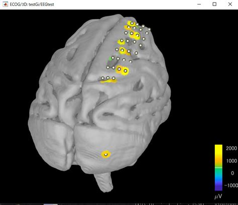 Display Area Of Ecog Signals On Cortex Are Too Large Discussions