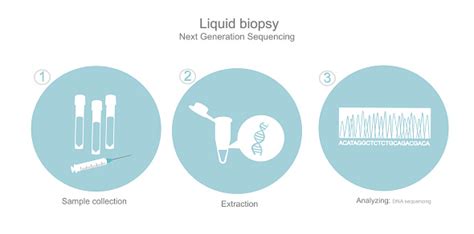 액체 생검 샘플에서 차세대 시퀀싱 기술을 사용한 Dna 시퀀싱의 검출 아이콘은 샘플 수집 추출 및 분석의 간단한 단계를 포함합니다 0명에 대한 스톡 벡터 아트 및 기타