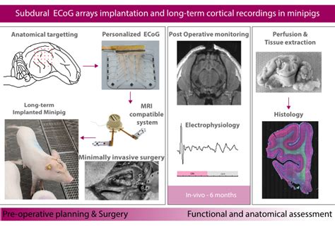 Subdural Soft Electrocorticography Ecog Array Implantation And Long Term Cortical Recording In