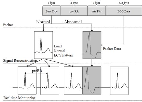 Process Of Ecg Signal Reconstruction Download Scientific Diagram
