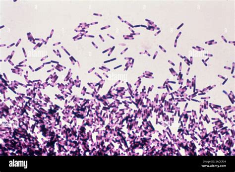 Clostridium Difficile Bacteria Light Micrograph These Gram Positive Rod Shaped Bacteria Cause