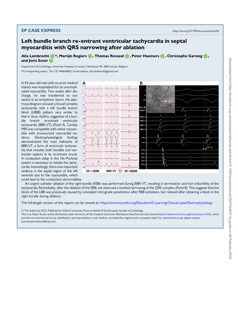 Pdf Left Bundle Branch Re Entrant Ventricular Tachycardia In Septal Myocarditis With Qrs
