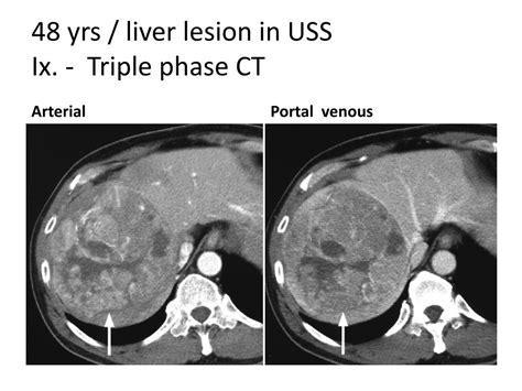Ppt Ct And Mri What Is Expected From The Radiological Technologists