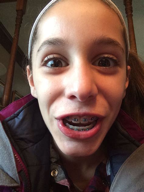 Pin By Kallie Gesouras On Kat Is The Best🐨💜 Cute Braces Young Teens