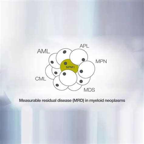 Aml Measurable Residual Disease Mrd Test In Delhi Ncr India Gdic