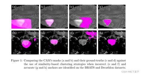 基于边界的医学图像弱监督语义分割细化框架boundarycam Csdn博客