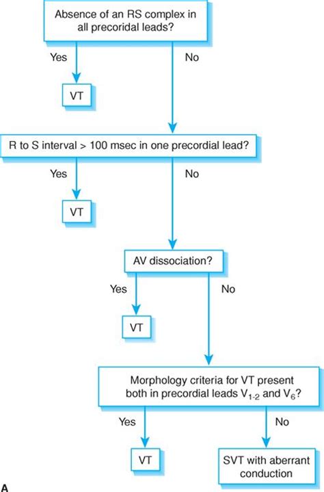Membedakan Vt Dan Svt Aberan ~ Yudha Utomo