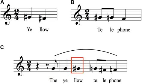 Accent Symbol Music