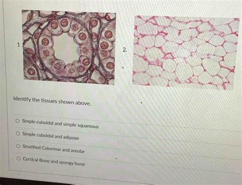 Solved Identify The Tissues Shown Above Simple Cuboidal And Simple