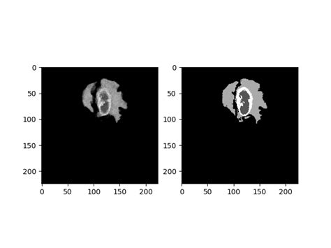 multi class segmentation discuss · issue 54 · juliawolleb diffusion