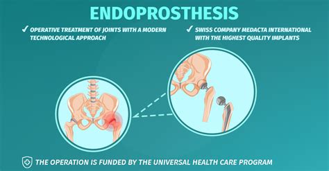 მენჯ ბარძაყის და მუხლის სახსრის ენდოპროთეზირება შვეიცარული იმპლანტებით National Surgery Center