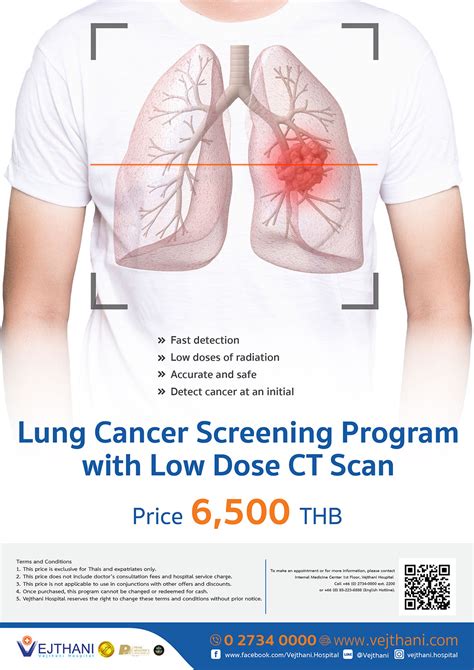Lung Cancer Screening Program With Low Dose Ct Scan Life Cancer Center