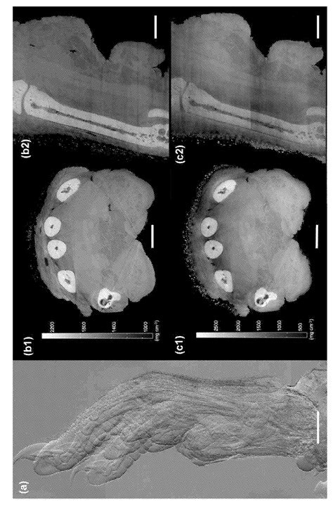 Low Dose Single Step Grating Based X Ray Phase Contrast Imaging Eureka Patsnap
