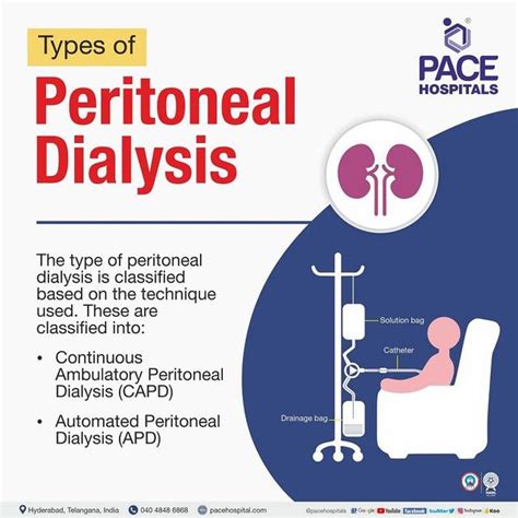 Peritoneal Dialysis Access Peritoneal Dialysis Dialysis Dialysis Nurse