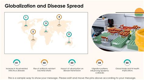 Epidemiological Transition Model Stages Ppt Outline Acp Ppt Sample
