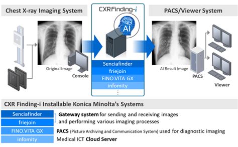 Highlight Introduction To Cxr Finding I An Ai Powered Chest X Ray Diagnostic Support System