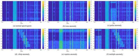 Spectrum Anomaly Detection Based On Spatio Temporal Network Prediction