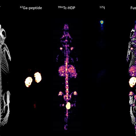 Simultaneous Spectct Images Obtained For Three Different Tracers
