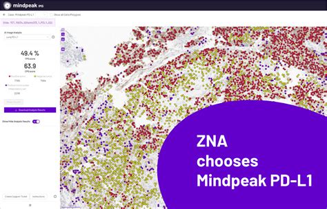 Mindpeak News Mindpeaks Pd L1 First Ai To Be Used In Labs In Belgium To Fight Cancer