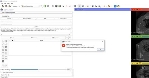 Dentalsegmentator Version Of 2024 04 22 Fails To Load Segmentation Result Support 3d Slicer
