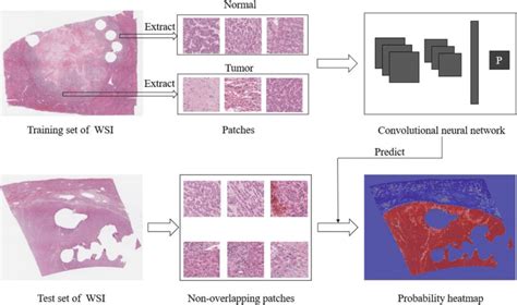 liver tumor detection framework download scientific diagram