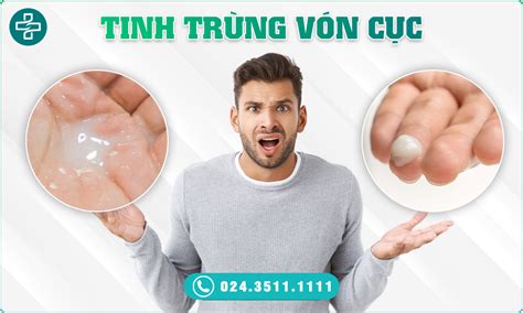 Tinh Trùng Vón Cục Có đáng Lo Không Bệnh Viện Nam Khoa Hà Nội Cơ
