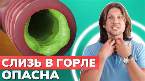 Почему у нас СКАПЛИВАЕТСЯ слизь в ГОРЛЕ Основные причины и последствия слизи в горле Youtube