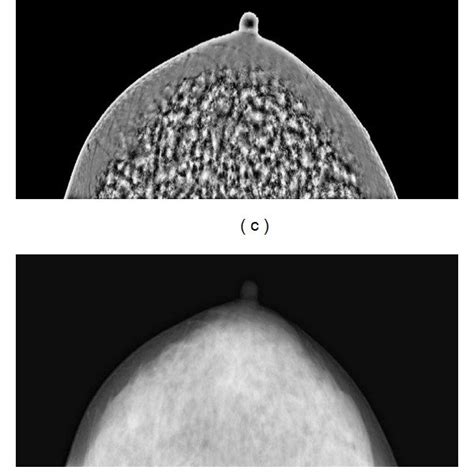 Comparison Of Contrast Enhancement Of Mammograms A Original Download Scientific Diagram