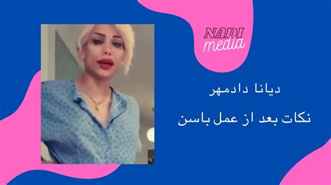 دیانا دادمهر از دردسر های پروتز باسن میگه Youtube
