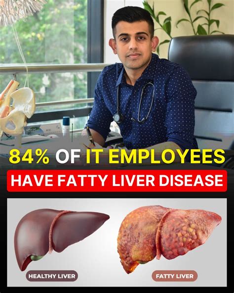 Mohammad Tahsinul Islam On Linkedin Should Be A Global Pattern