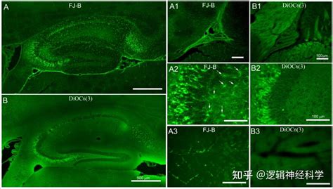 Prog Neurobiol︱吉林大学李艳超团队研发出新型神经元死亡检测方法对神经疾病研究具有重要和深远意义 知乎