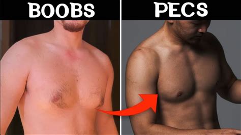 How To Get Rid Of Chest Fat Teenager At Kai Hartung Blog