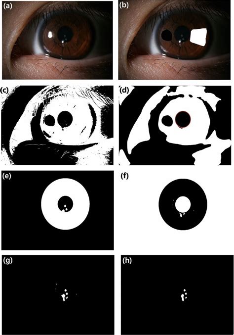 Demonstration Of All The Steps In The Process Of Segmentation Of