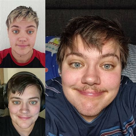 Ftm Before And After Testosterone