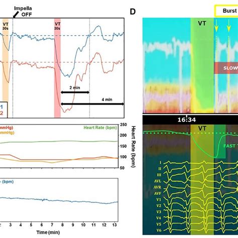 Clinical Parameters Of Case Studies A Tissue Oxygenation Index Toi Clinical Parameters Of Case Studies A Tissue Oxygenation Index Toi