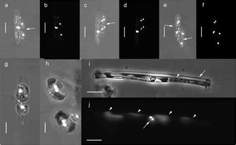 Confocal Z Stack Projections Ah And Lm Micrographs I J Of