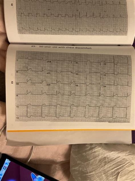 Calculate The Volume In ML Of A MNaOH Solution Chegg