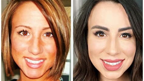 Does Botox Make You Look Older After It Wears Off Ds News