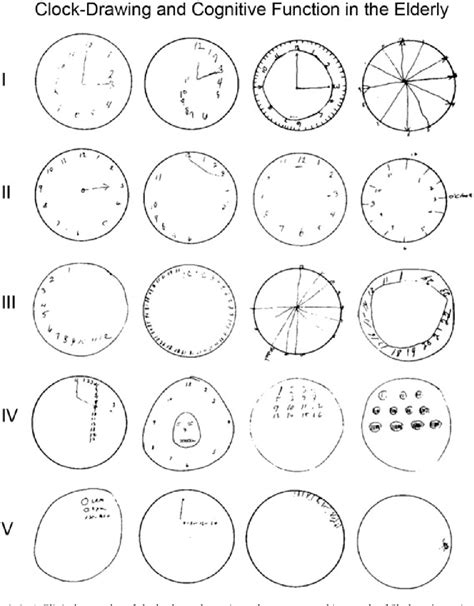 Clock Drawing Test Numbers On One Side At Victoria Jenkins Blog
